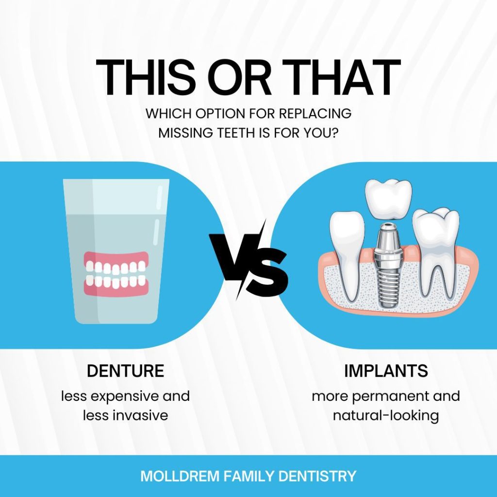 Dentures vs. Dental Implants: What’s the Difference? | Molldrem Family ...
